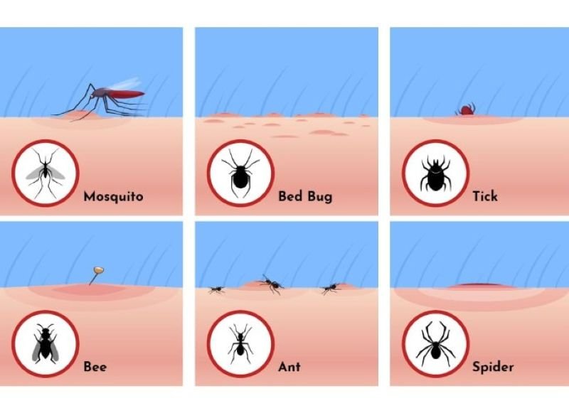 6 Jenis Gigitan Serangga dan Gambarnya - KATA OMED